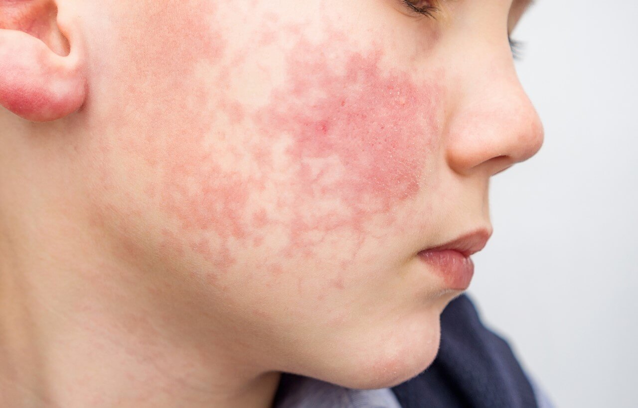 Essoufflement et bouffée de chaleur : comment se calmer